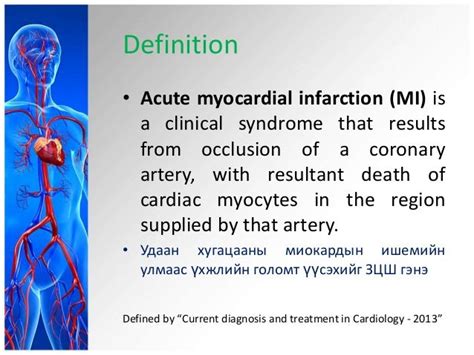 Acute Myocardial Infarction