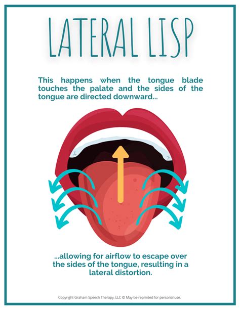 Freebies Graham Speech Therapy