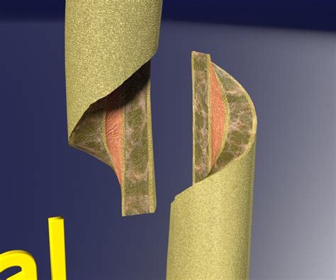 Artstation Spiral Fracture Skeleton Labelled Femur 3d Model Resources