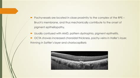 Andreea Moraru Pachychoroid Spectrum Of Diseases Pdf