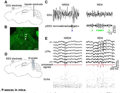 Sleep State Dependent Modulations Of Hippocampal Theta 1 Oscillations
