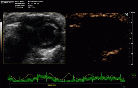 Microfluidic Production Of Microbubbles University Of Virginia School Of Engineering And