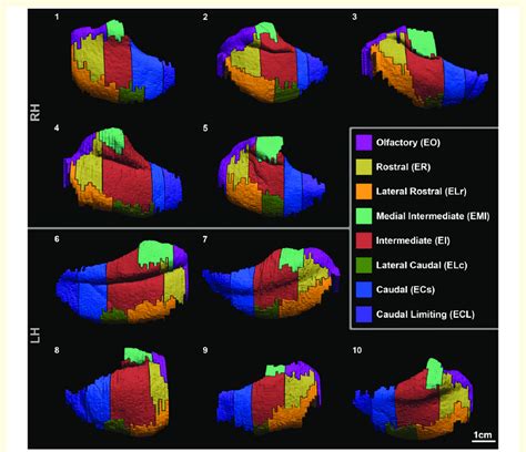 3d Isosurface Reconstruction Of Entorhinal Cortex Subfield Labelling Download Scientific