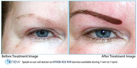 Semipermament Eyebrow Make Up Results Skin Care Clinic Royal Leamington Spa