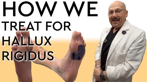How We Treat Hallux Rigidus Youtube