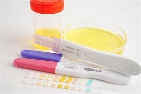 Urinalysis Pregnancy Test And Urine Cup For Female Of Ovulation Day