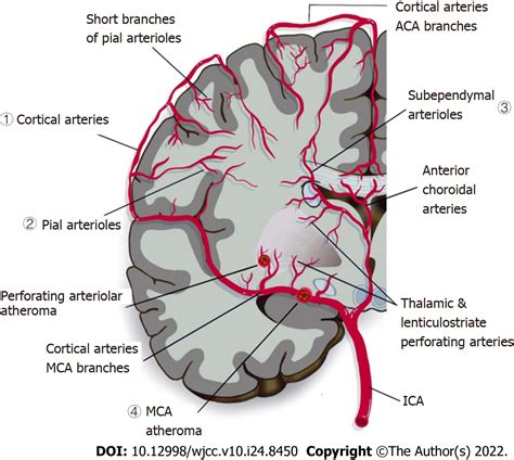 Anterior Choroidal Artery Supply