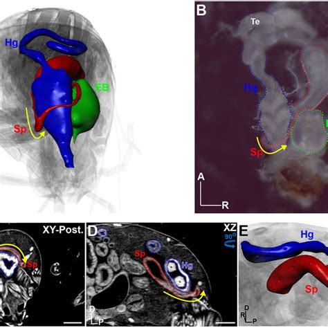 µ Ct Of Adult Drosophila Melanogaster Highlighting Muscle And Heart