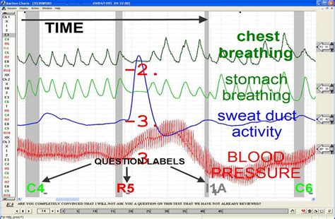 Understanding The Polygraph Chart A Deep Dive Into Lie Detection Lie Detector Test