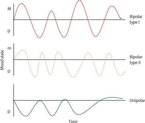 Bipolar Disorder Diagnosis Challenges And Future Directions The Lancet