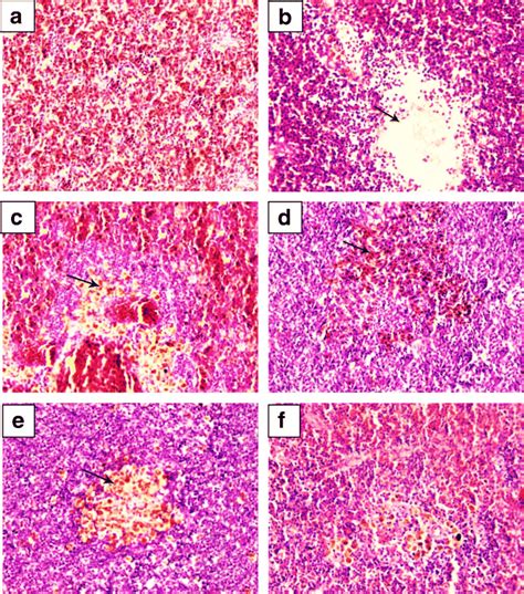 Hande Stained Sections Of Spleen Ac Of Nile Tilapia Infected With A Download Scientific