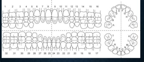 Chapter 12 28 48 Charting And Classification Of Restorations