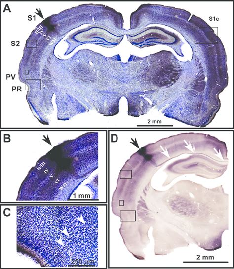 Histological Rat Brain Section Doublestained With Nissl Showing The Download Scientific Diagram
