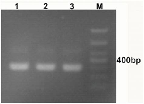 A 2 Agarose Gel Showing The Nested Round Pcr Product Of Nida Like
