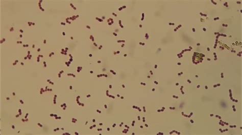 Gram Positive Cocci In Singles Pairs And Chains Of Lactococcus Garieae Youtube