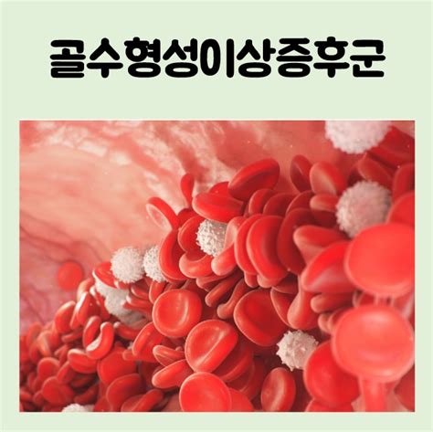 골수형성이상증후군 진단 치료 예후 알아보기 네이버 블로그