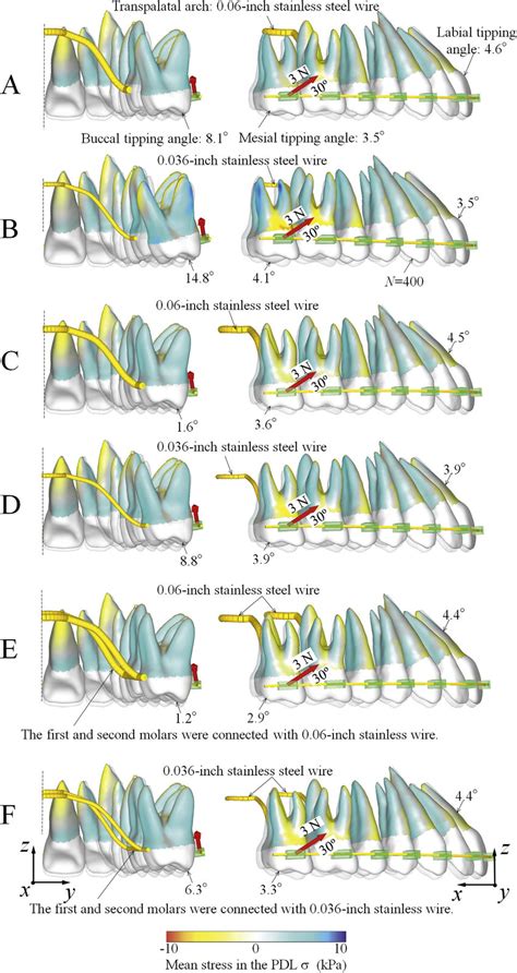 Tooth Movement Patterns At N 5 400 When Tpas Are Fixed To The Maxillary