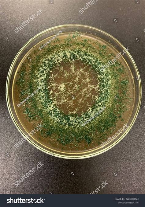 Categoría «hongo Trichoderma De Fotos E Imágenes Shutterstock