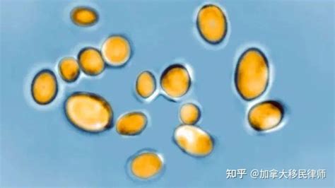 Cdc警告 致命真菌扩散全美 致死率近40有耐药性 加拿大已43例 知乎
