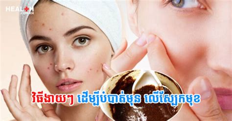 វិធី ងាយៗ ដើម្បី បំបាត់ មុន លើ ស្បែក មុខ