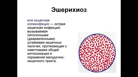 Острые кишечные инфекции у детей Youtube