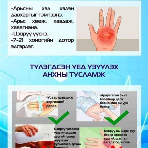 ТҮЛЭГДЭЛТЭЭС УРЬДЧИЛАН СЭРГИЙЛЬЕ Сүхбаатар дүүргийн онцгой байдлын хэлтэс