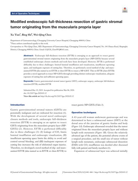 Pdf Modified Endoscopic Full Thickness Resection Of Gastric Stromal Tumor Originating From The