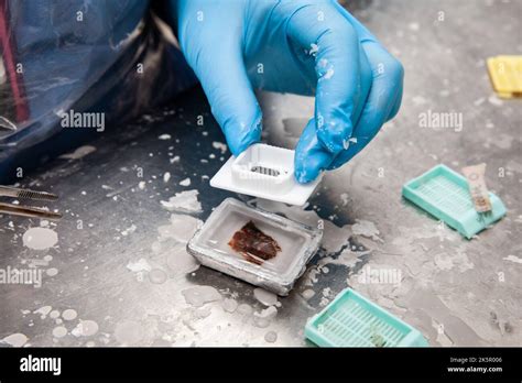 Scientist Embedding Tissues In Paraffin Blocks For Sectioning Pathology Laboratory Cancer