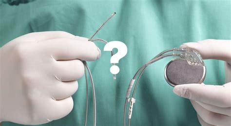 Frequently Asked Questions About Temporary Pacemaker Aventin Health