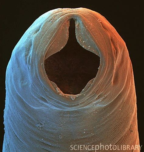 Infection Landscapes Hookworm