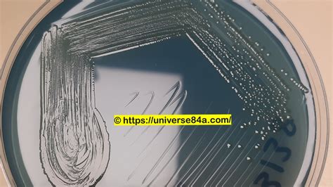 Escherichia Hermannii Introduction Morphology Pathogenicity Lab