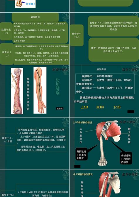 骨科肱骨干骨折素材ppt模板卡卡办公