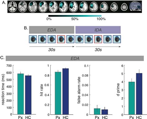 Figure 1 From Lateral Prefrontal Cortex Lesion Impairs Regulation Of