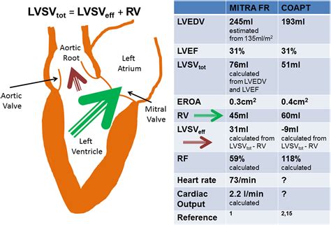 Assessing Functional Mitral Regurgitation With Exercise Echocardiography My Xxx Hot Girl