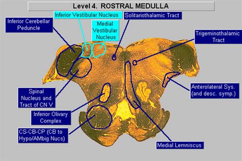 Vestibular Nuclei Wikipedia