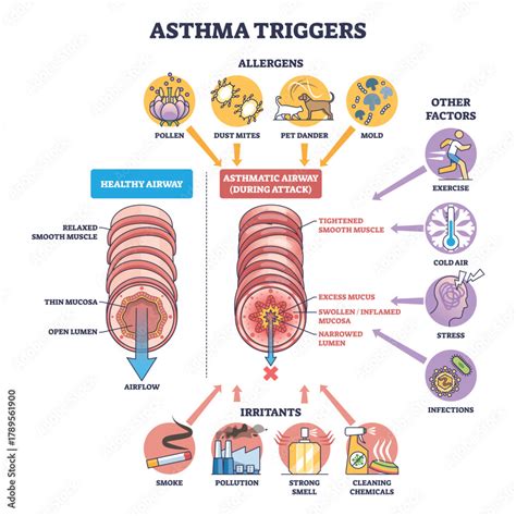 Asthma Triggers Diagram Shows Healthy Vs Asthmatic Airway With