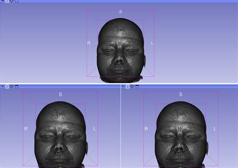 A Problem About Camera Position Setting Support 3d Slicer Community