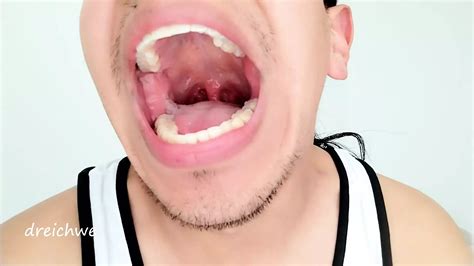 Big Mouth Uvula Fetish Gay Pornstar Amateur Porn Feat Dreichwe Xhamster