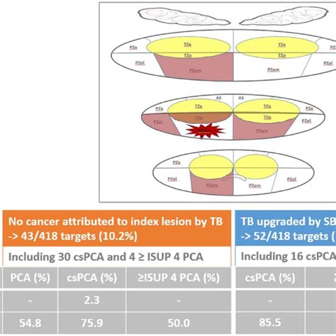 Cancer Detection By Systematic Biopsy And Target Biopsy According To Download Scientific