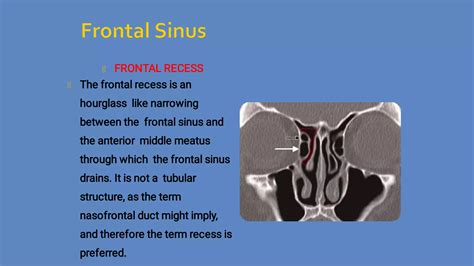Ct Anatomy Of Paranasal Sinuses Pns Pkpdf Ppt Pdf