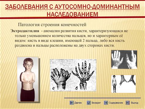 Генетика человека Генные болезни презентация онлайн