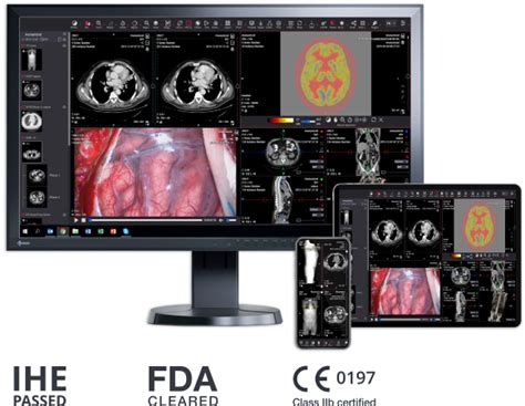 Dicom Viewer Bitbazar