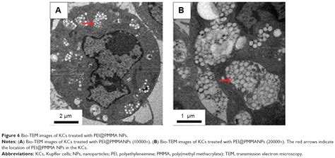 Amphiphilic Core Shell Nanoparticles Containing Dense Polyethyleneimin Ijn