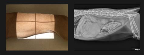 Xiphoid Process Vertebral Level