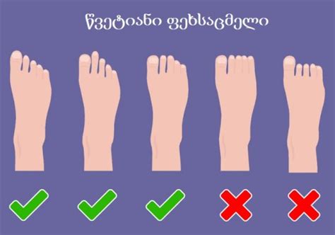 როგორ შევინარჩუნოთ ლამაზი ფეხები და დავიცვათ ტერფები დაზიანებისგან