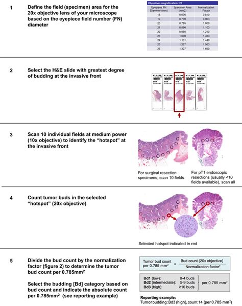 Recommendations For Reporting Tumor Budding In Colorectal Cancer Based On The International