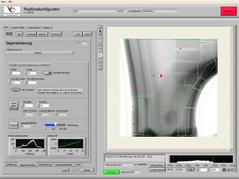 Automated Defect Recognition Via Digital X Ray Inspection