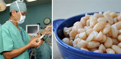 Colonoscopy Prep Tips You Need To Know Before Procedure