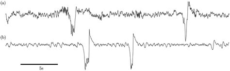 Comparison Of Human Eeg With Model Output In Regime N2 Qualitative