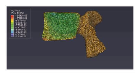 Contour Plot Of Strain On The Vertebral Bodies Of Lumbar Finite Element Download Scientific